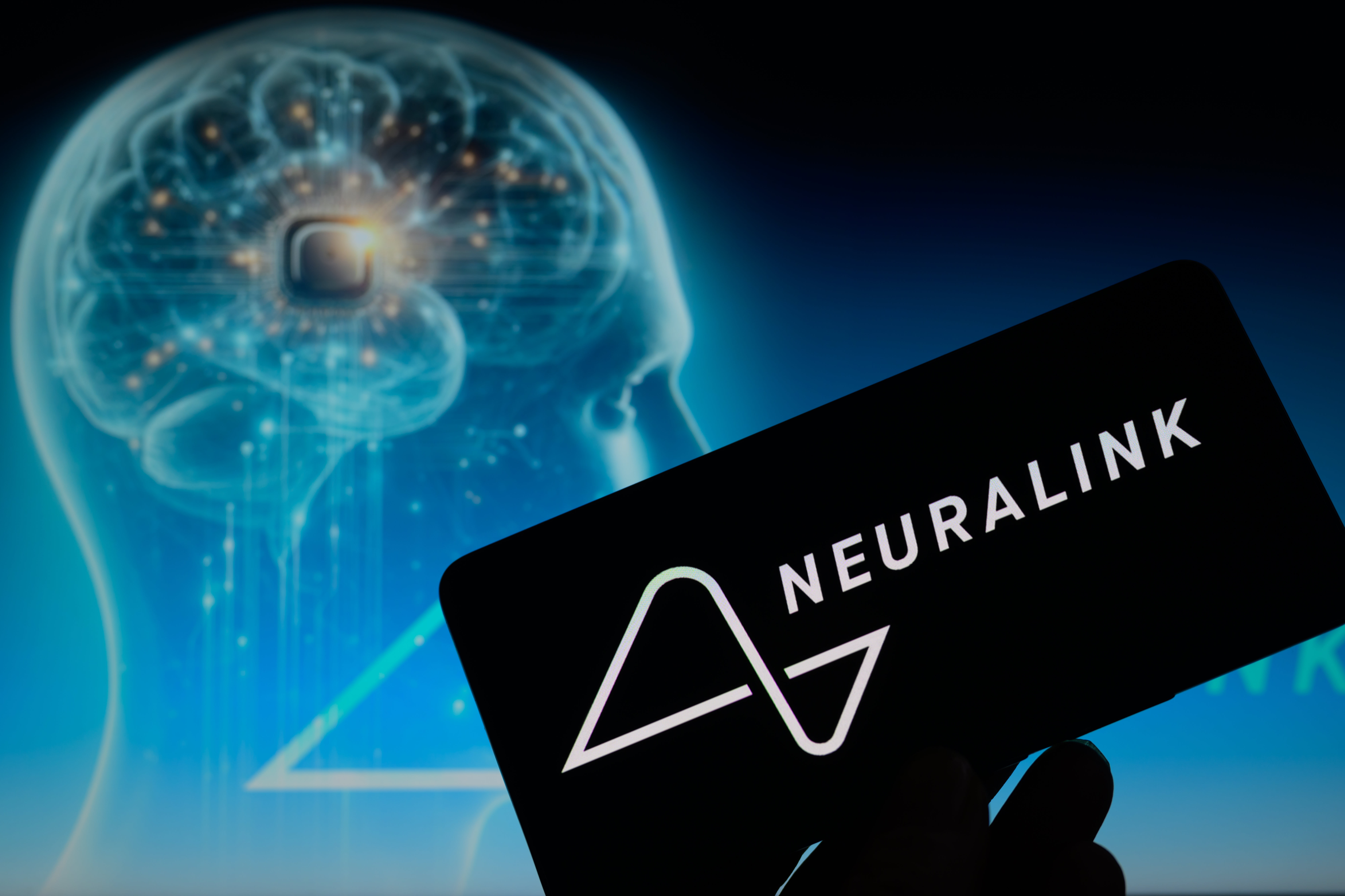 Neuralink 2025 Company Profile: Valuation, Funding & Investors | PitchBook